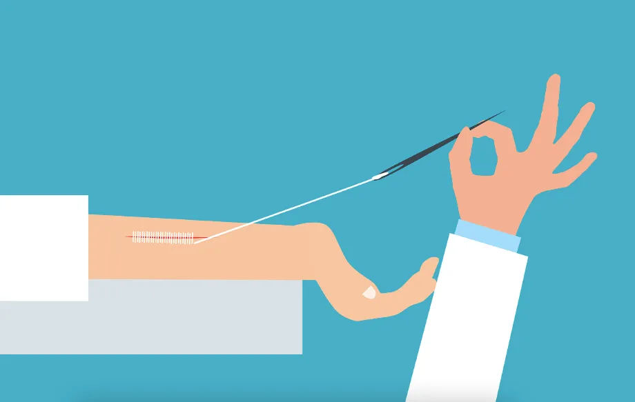 Healing Vascular Wounds: Advanced Therapies at OWCCenter - OWC Center