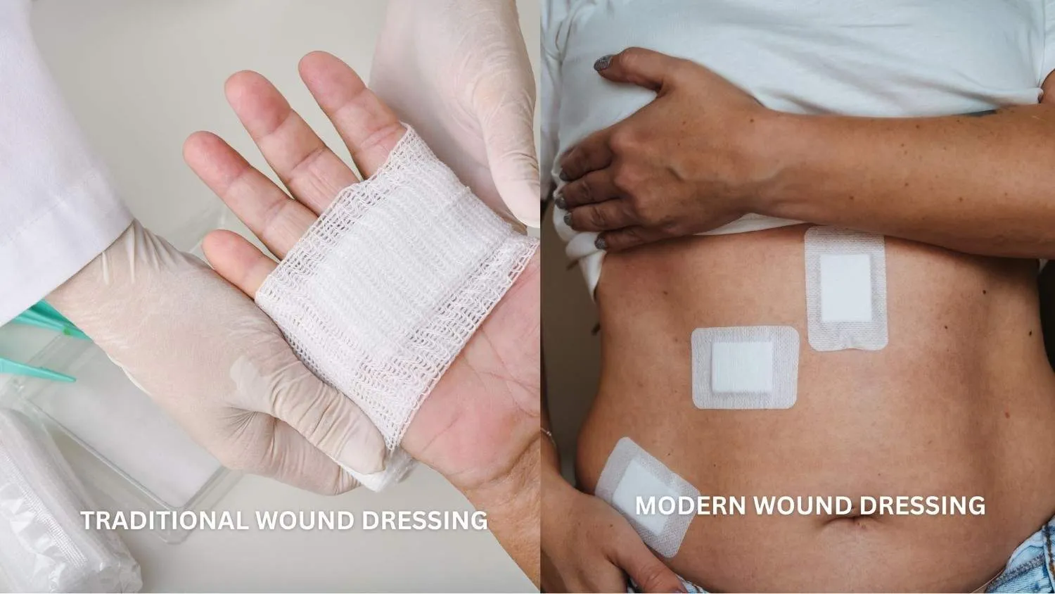 Comparing Traditional vs. Modern Wound Dressing Materials