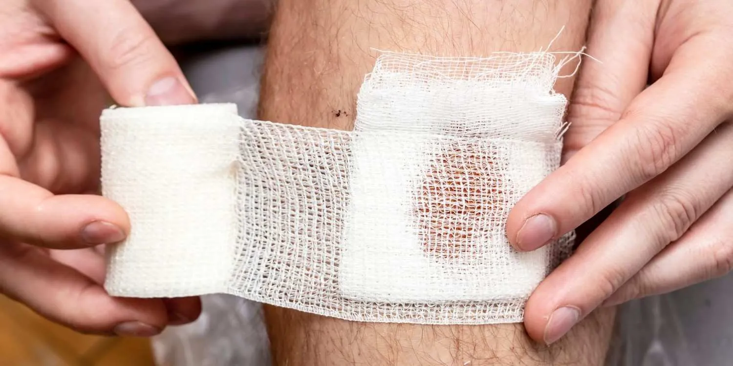 Identifying Wound Healing Plateaus and What to Do