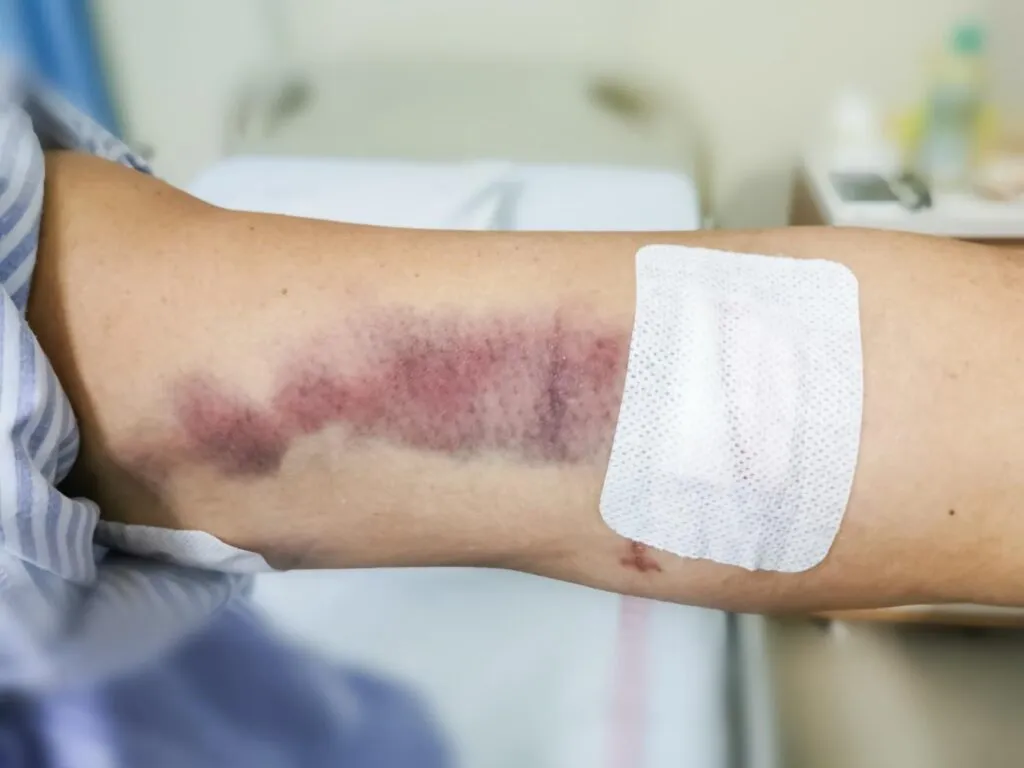 Why Chronic Infections Delay Wound Healing