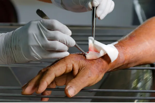 The Physical Examination in Wound Care: Key Steps & Importance