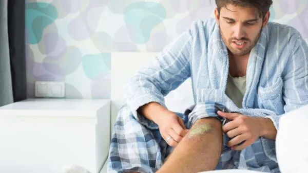 How to Address Odor and Drainage from Chronic Wounds